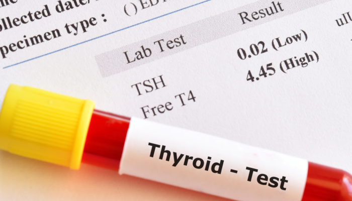 TSH nedir, TSH düşüklüğü, yüksekliği, normal değeri - Sağlık Haberleri