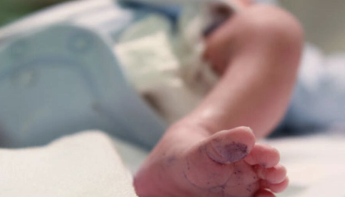 Diphallia nedir? İşte Diphallia belirtileri ve tedavisi - Sağlık Haberleri