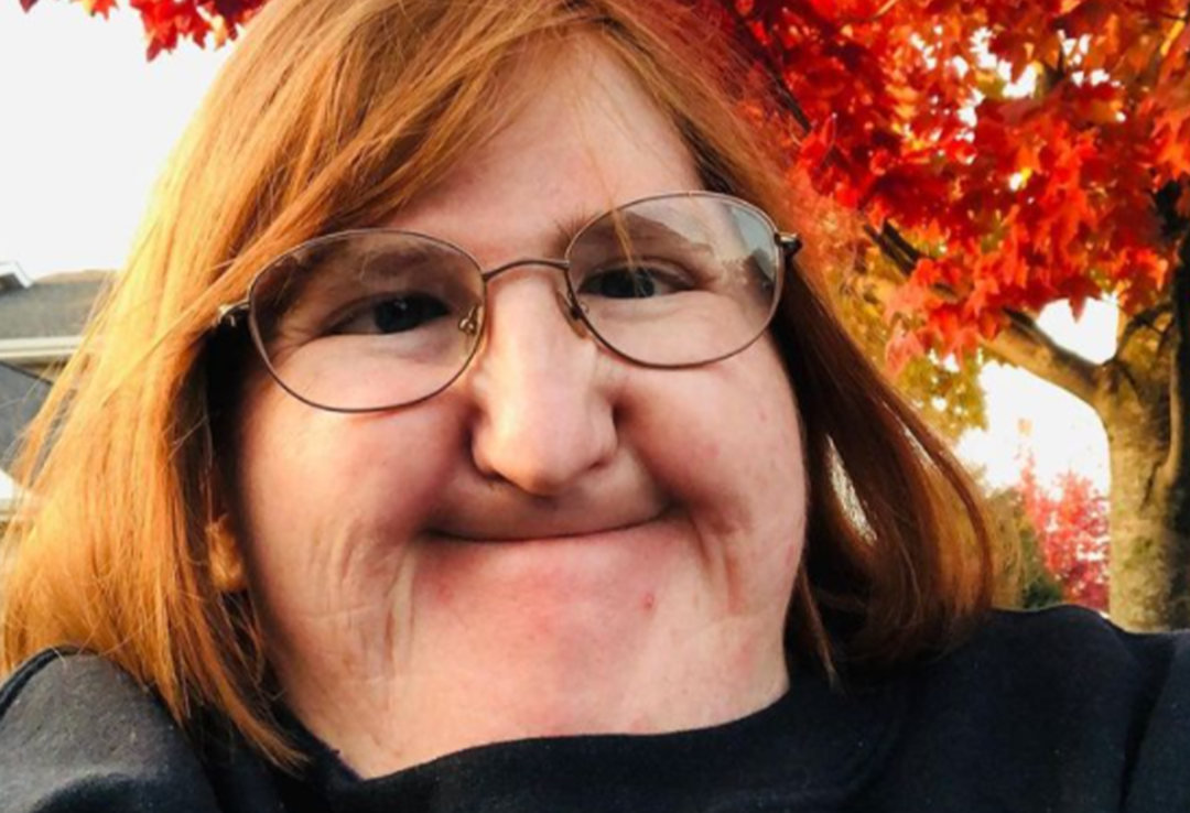 Melissa Blake, kendisini eleştirenlere New York Moda Haftası’nda ...