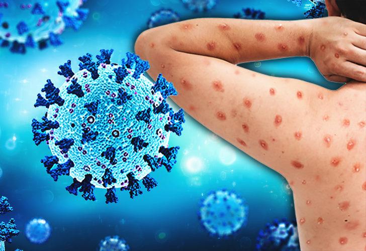 domates gribi - uludağ sözlük