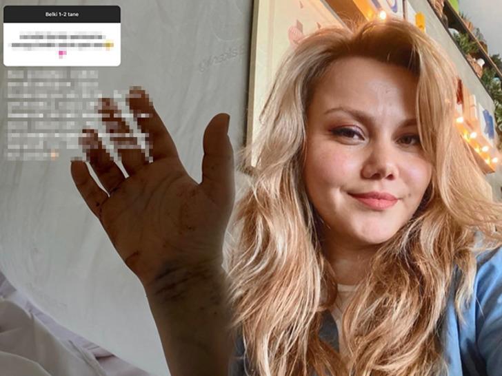 Eşi tarafından 32 yerinden bıçaklanmıştı! Fenomen Merve Veziroğlu'ndan ...