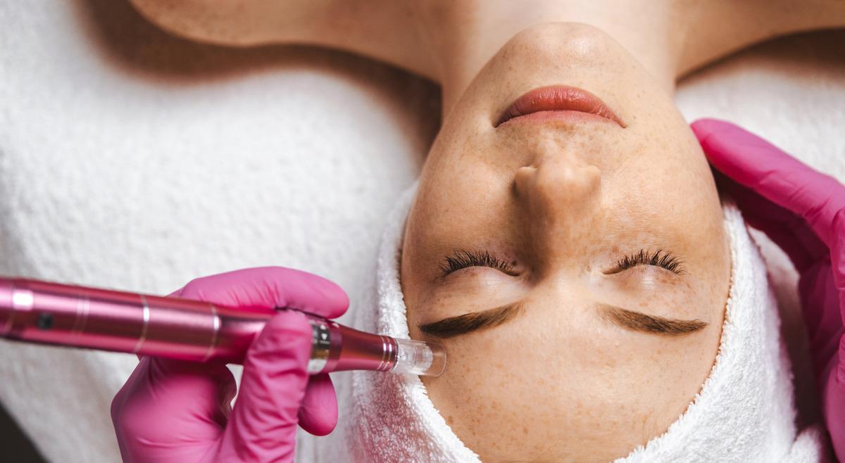 Dermapen tedavisi faydaları nelerdir? Dermapen nedir, ne işe yarar ...