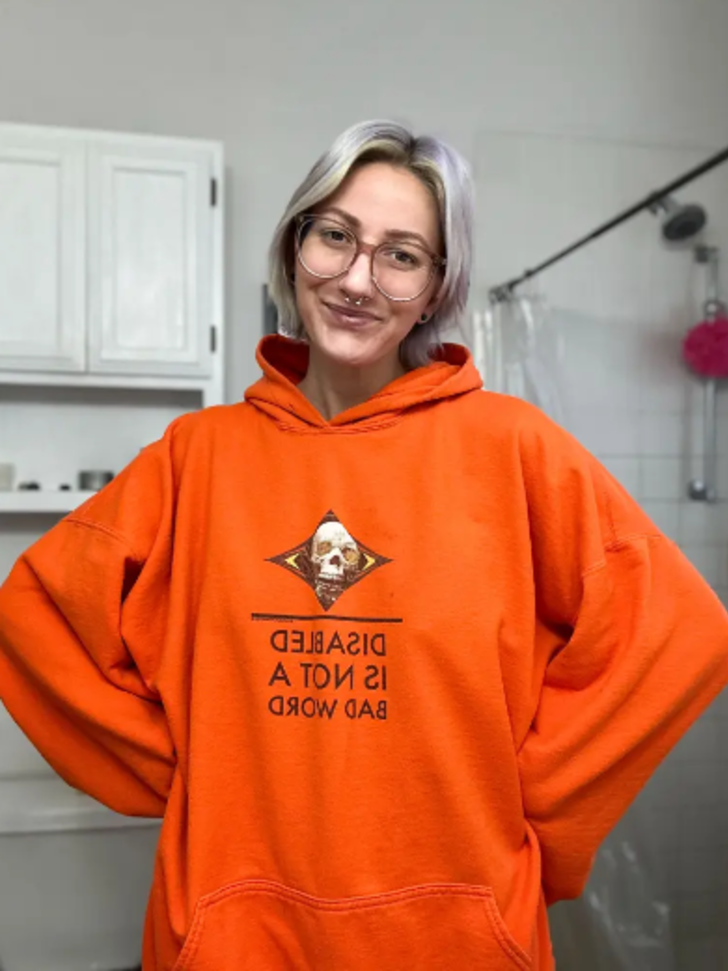 'Meniye alerjim var' dedi... Sosyal medyada itirafı gündem yarattı ...