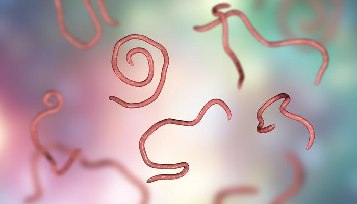 Kıl kurdu nedir, 3 saatte kıl kurdu nasıl dökülür? Kıl kurdu ...